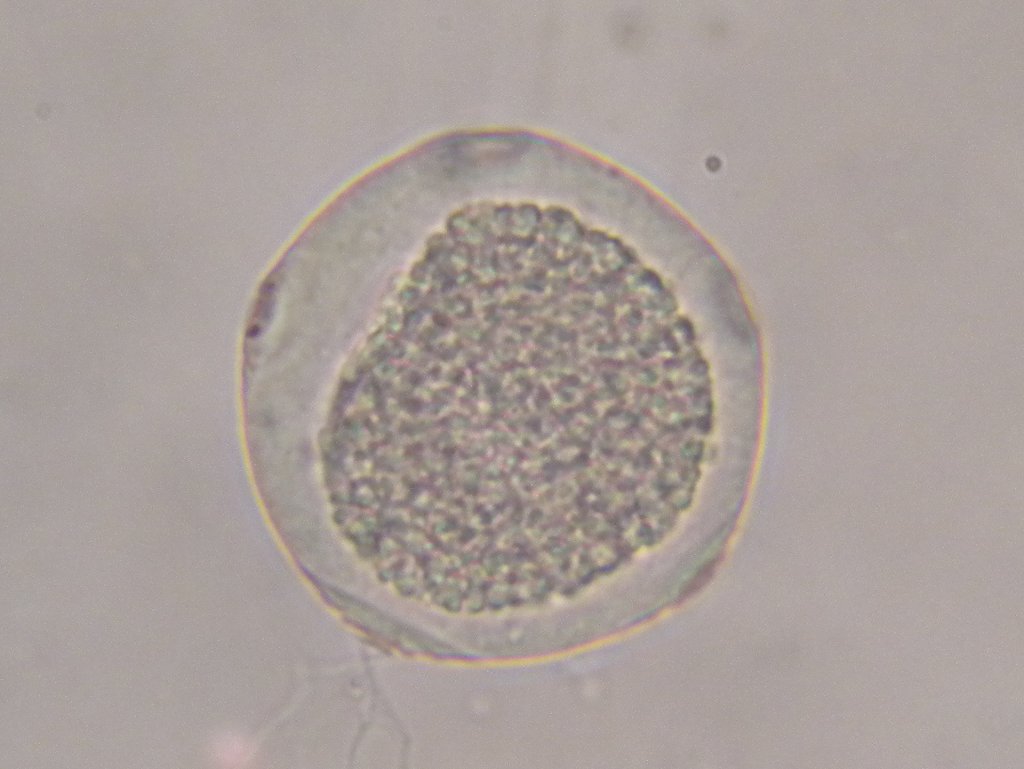Pollen bestimmen 2 — Landesbildungsserver Baden-Württemberg