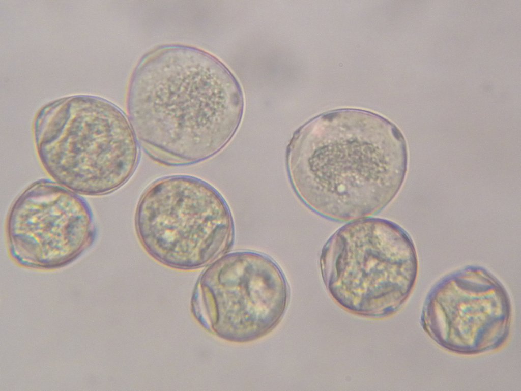Pollenpraktikum - Ergebnisse — Landesbildungsserver Baden-Württemberg